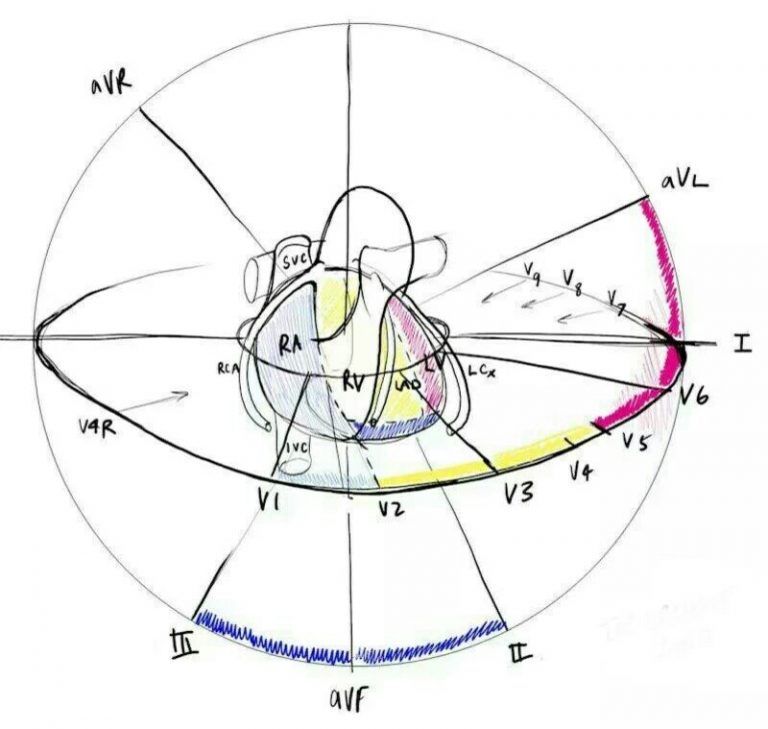 ️‍🔥 Derivaciones del electrocardiograma: precordiales y de los miembros