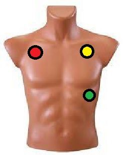 Derivaciones Especiales Del Electrocardiograma Y Monitorizaci n Derivaciones Especiales Del Electrocardiograma Y Monitorizaci n