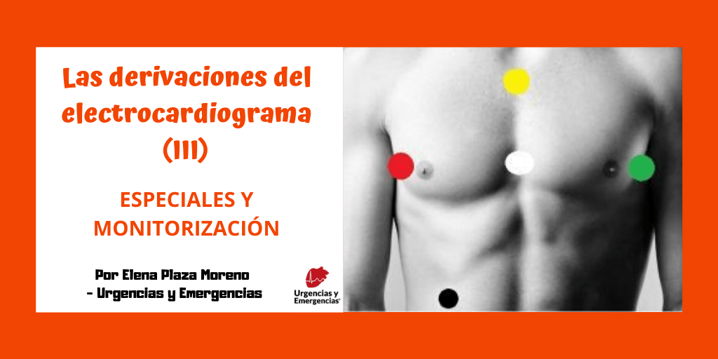 Derivaciones Especiales Del Electrocardiograma Y Monitorizaci n Derivaciones Especiales Del Electrocardiograma Y Monitorizaci n