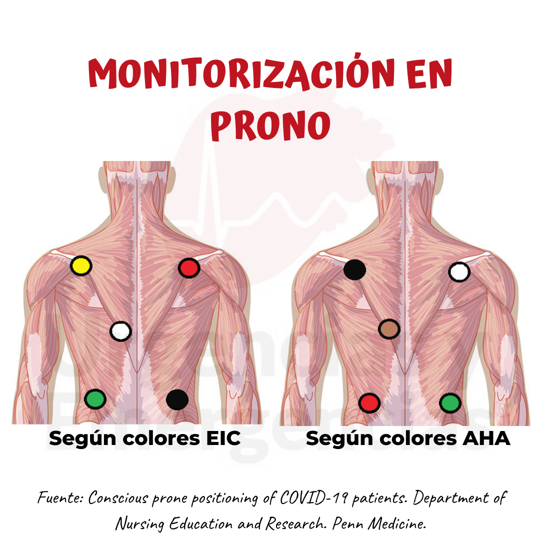 Monitorización y electrocardiograma en prono - Urgencias y emergencias®