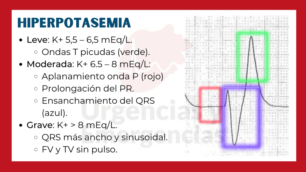 Hiperpotasemia: algoritmo ERC 2021 y electrocardiograma